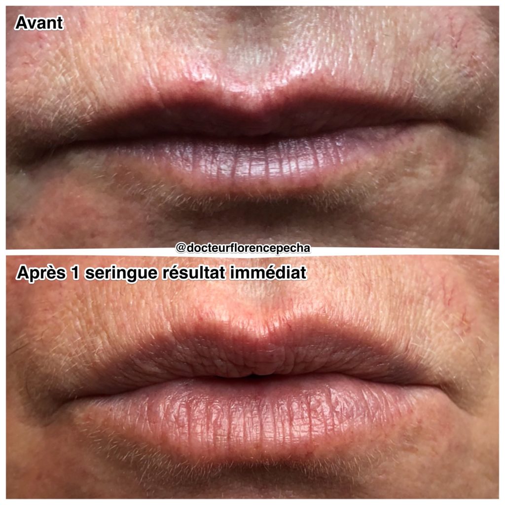 Titre - Dr Florence PECHA, Ophtalmologue et Médecine Esthétique à Cannes