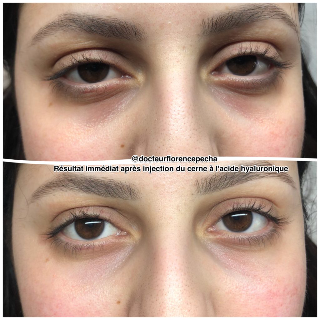 Titre - Dr Florence PECHA, Ophtalmologue et Médecine Esthétique à Cannes